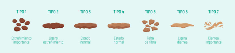 La escala de Bristol: clasificación de las heces | GoodGut
